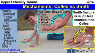 Upper Extremity Trauma Wrist complete MSK Radiology Lecture | PPSX
