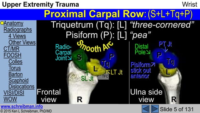 Upper Extremity Trauma Wrist complete MSK Radiology Lecture | PPT