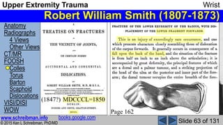 Upper Extremity Trauma Wrist complete MSK Radiology Lecture | PPSX