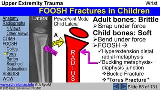 Upper Extremity Trauma Wrist complete MSK Radiology Lecture | PPSX