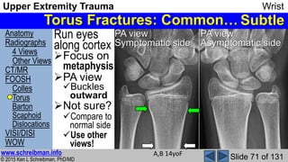 Upper Extremity Trauma Wrist complete MSK Radiology Lecture | PPSX