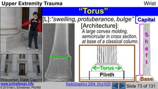 Upper Extremity Trauma Wrist complete MSK Radiology Lecture | PPSX