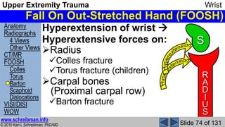 Upper Extremity Trauma Wrist complete MSK Radiology Lecture | PPSX