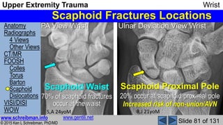 Upper Extremity Trauma Wrist complete MSK Radiology Lecture | PPSX