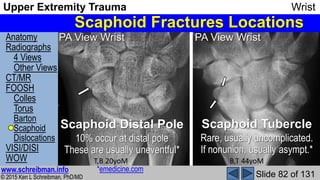 Upper Extremity Trauma Wrist complete MSK Radiology Lecture | PPSX
