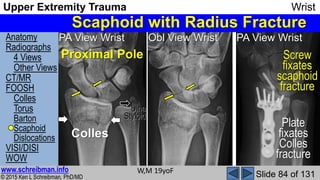 Upper Extremity Trauma Wrist complete MSK Radiology Lecture | PPSX