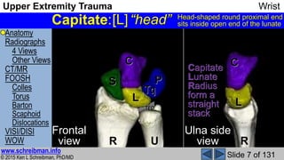 Upper Extremity Trauma Wrist complete MSK Radiology Lecture | PPSX