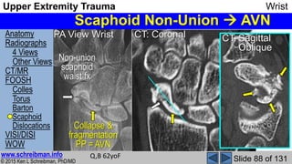 Upper Extremity Trauma Wrist complete MSK Radiology Lecture | PPSX