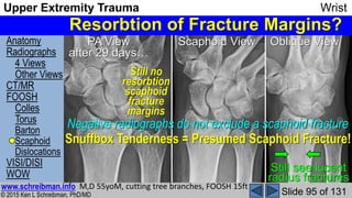 Upper Extremity Trauma Wrist complete MSK Radiology Lecture | PPSX