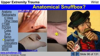Upper Extremity Trauma Wrist complete MSK Radiology Lecture | PPSX