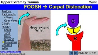 Upper Extremity Trauma Wrist complete MSK Radiology Lecture | PPSX