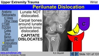 Upper Extremity Trauma Wrist complete MSK Radiology Lecture | PPSX