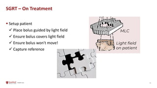 3D Printed Bolus in SGRT - SGRT USA 2024 | PPT