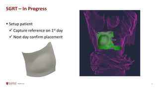 3D Printed Bolus in SGRT - SGRT USA 2024 | PPT