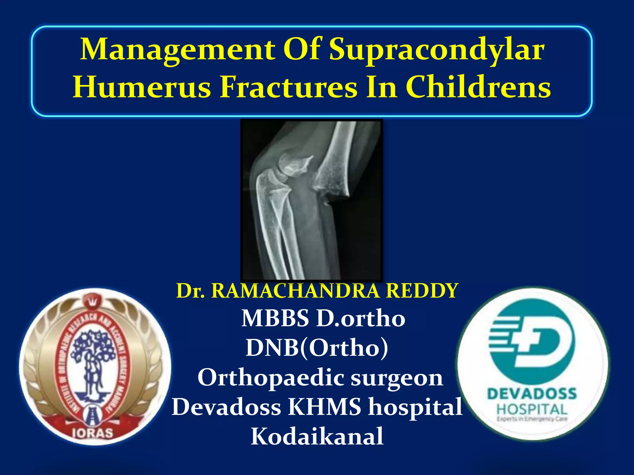 Sc humerus fractures in childrens by KRR | PPTX