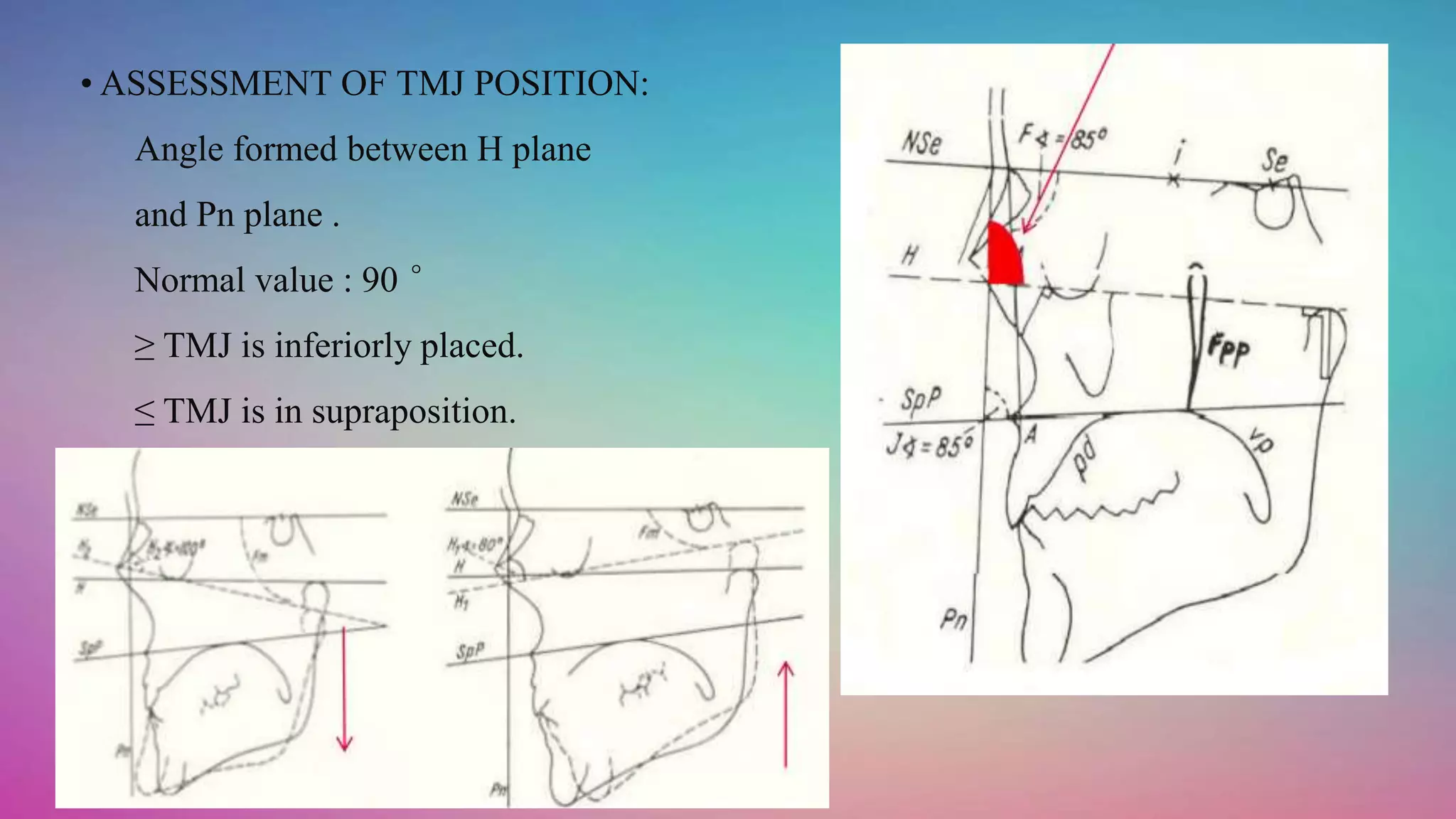 Schwarz Analysis | PPTX