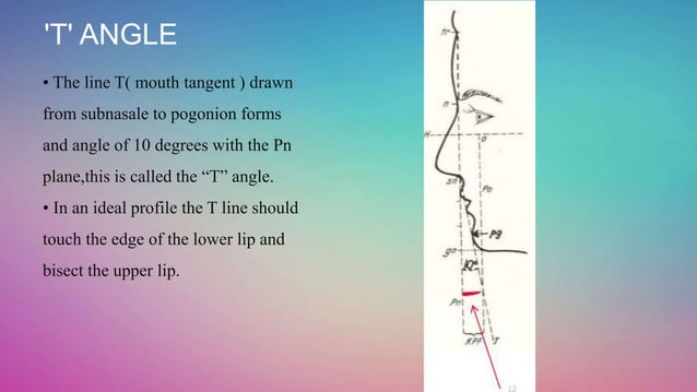 Schwarz Analysis | PPTX