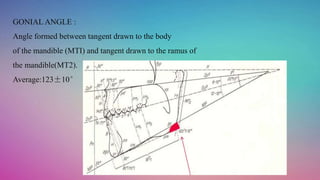 Schwarz Analysis | PPTX