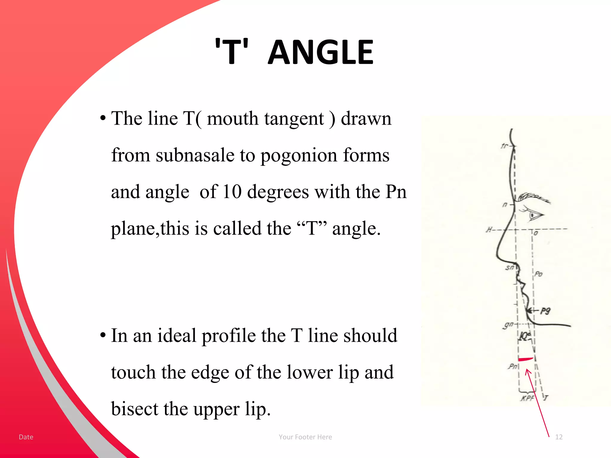 Schwarz analysis (mothi krishna) | PPTX