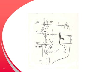 Schwarz analysis (mothi krishna) | PPTX
