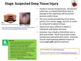SCI-Pressure-Injury-Toolkit_L-Katte.pptx