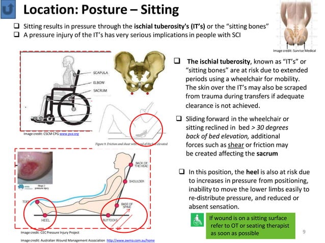 SCI-Pressure-Injury-Toolkit_L-Katte.pptx