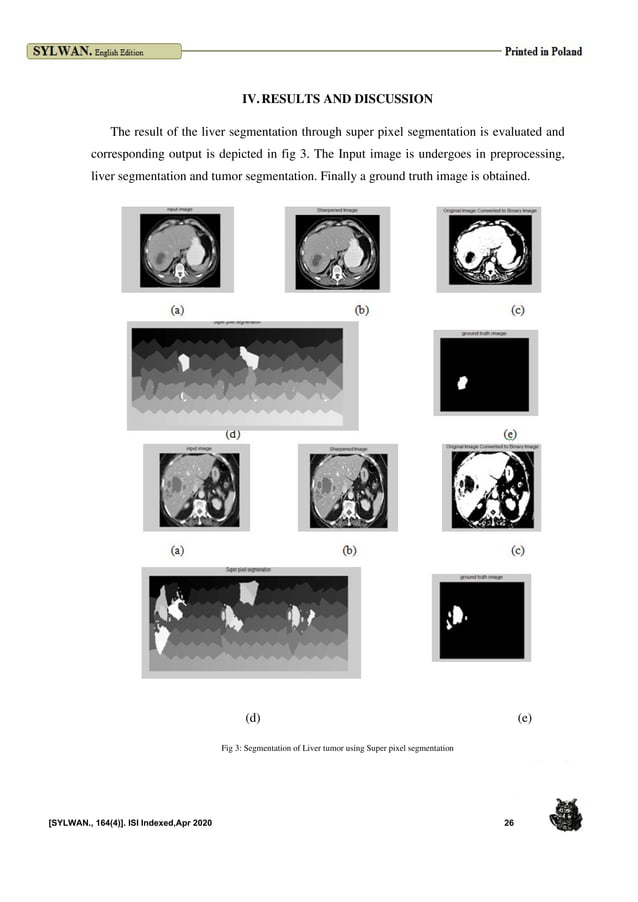 Enhancing Segmentation Approaches From Gaussian Mixture Model And Expected Maximization To Super