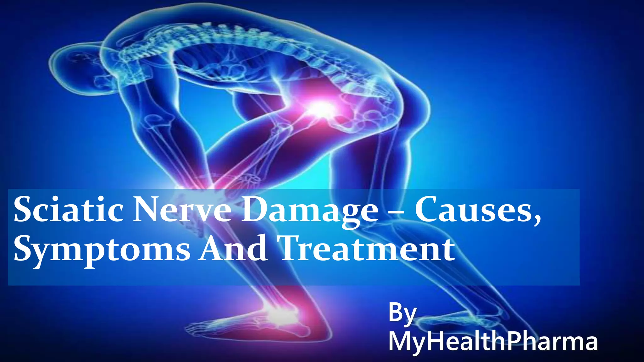 Sciatic Nerve Damage – Causes And Treatment | PPTX