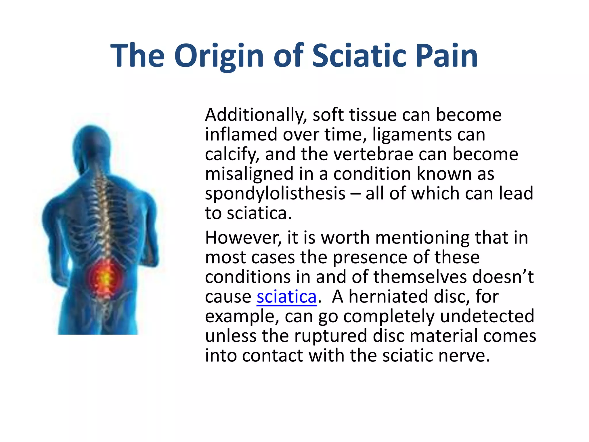 Understanding the Causes, Symptoms, and Treatments for Sciatica | PPTX