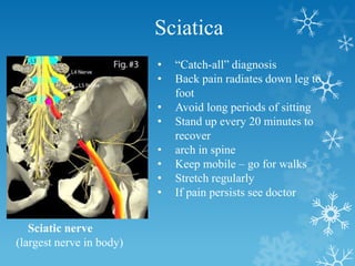 Sciatica | PPTX