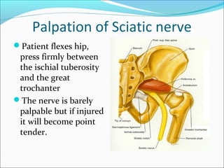 Sciatica by Farshid Mokhberi | PPT