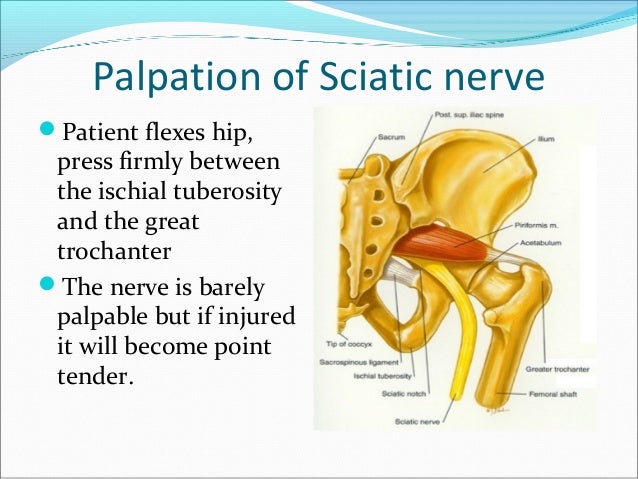 Sciatica by Farshid Mokhberi