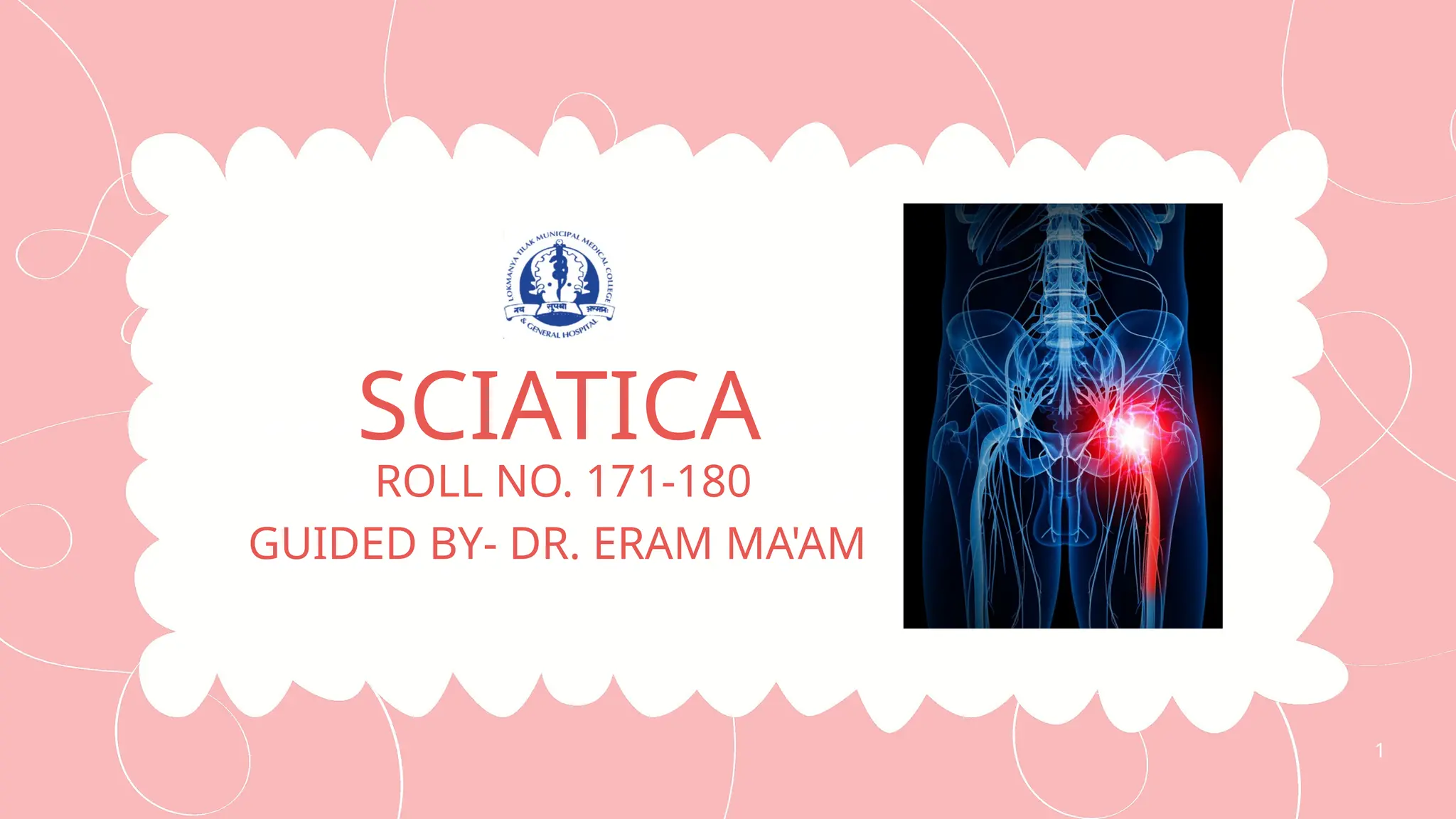 SCIATICA.pptx sciatica lokmanya tilak municipal medical college | PPTX