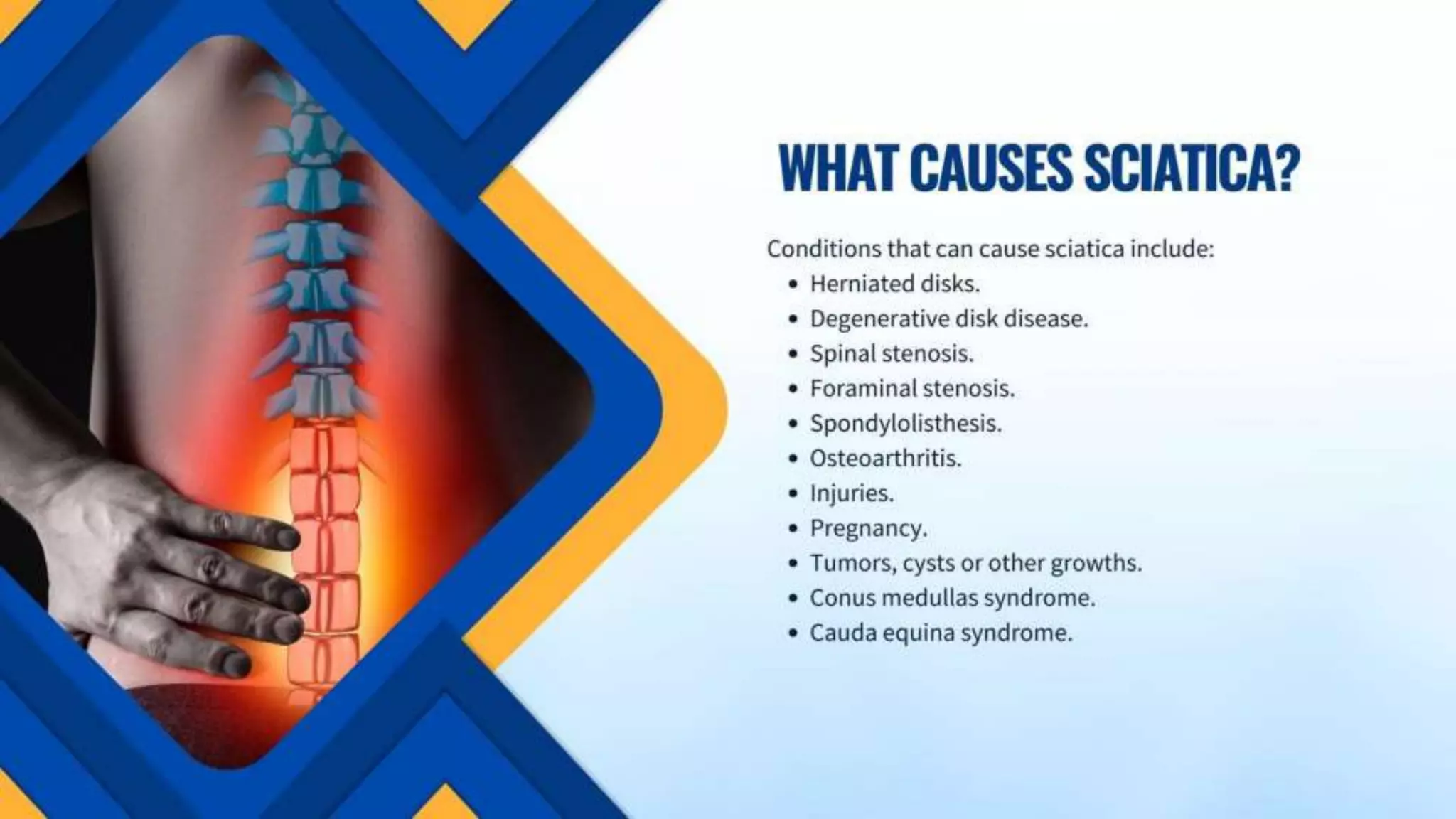 Sciatica- Types, symptoms, causes and Treatments | PPTX | Brain and Nervous System Disorders ...