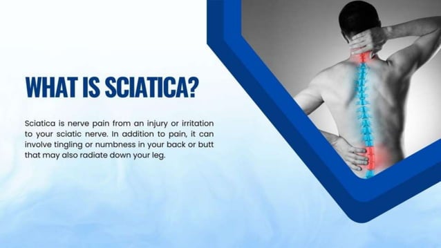 Sciatica- Types, symptoms, causes and Treatments | PPTX