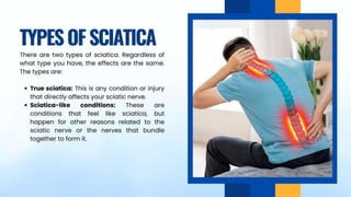 Sciatica- Types, symptoms, causes and Treatments | PPTX