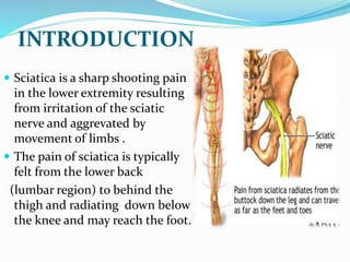 sciatica final.pptx
