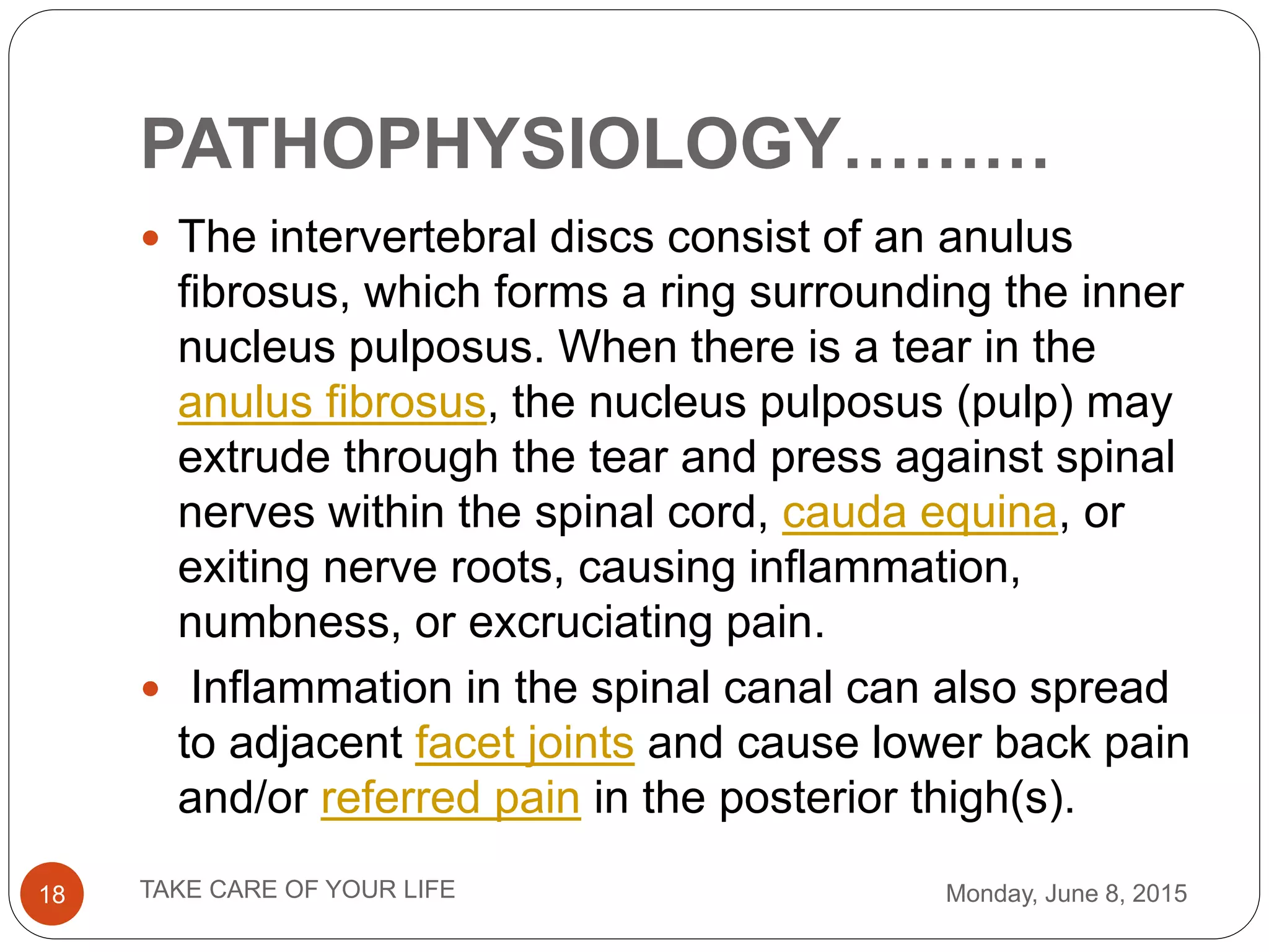 Sciatica | PPTX