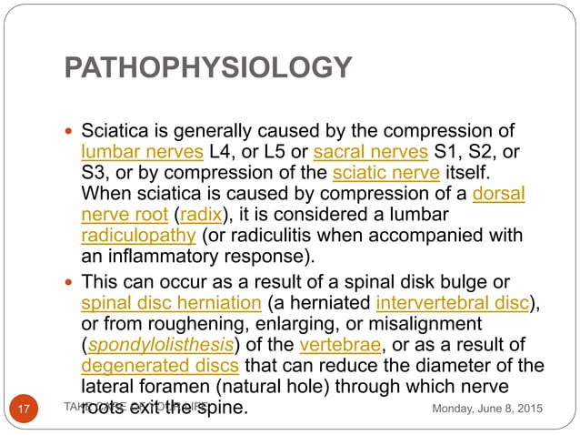 Sciatica | PPTX | Death, Injury, or Military Conflict | Sensitive Topics