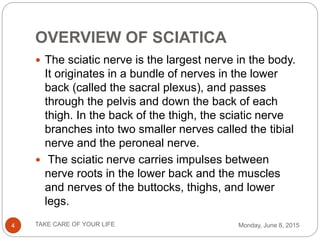 Sciatica | PPTX