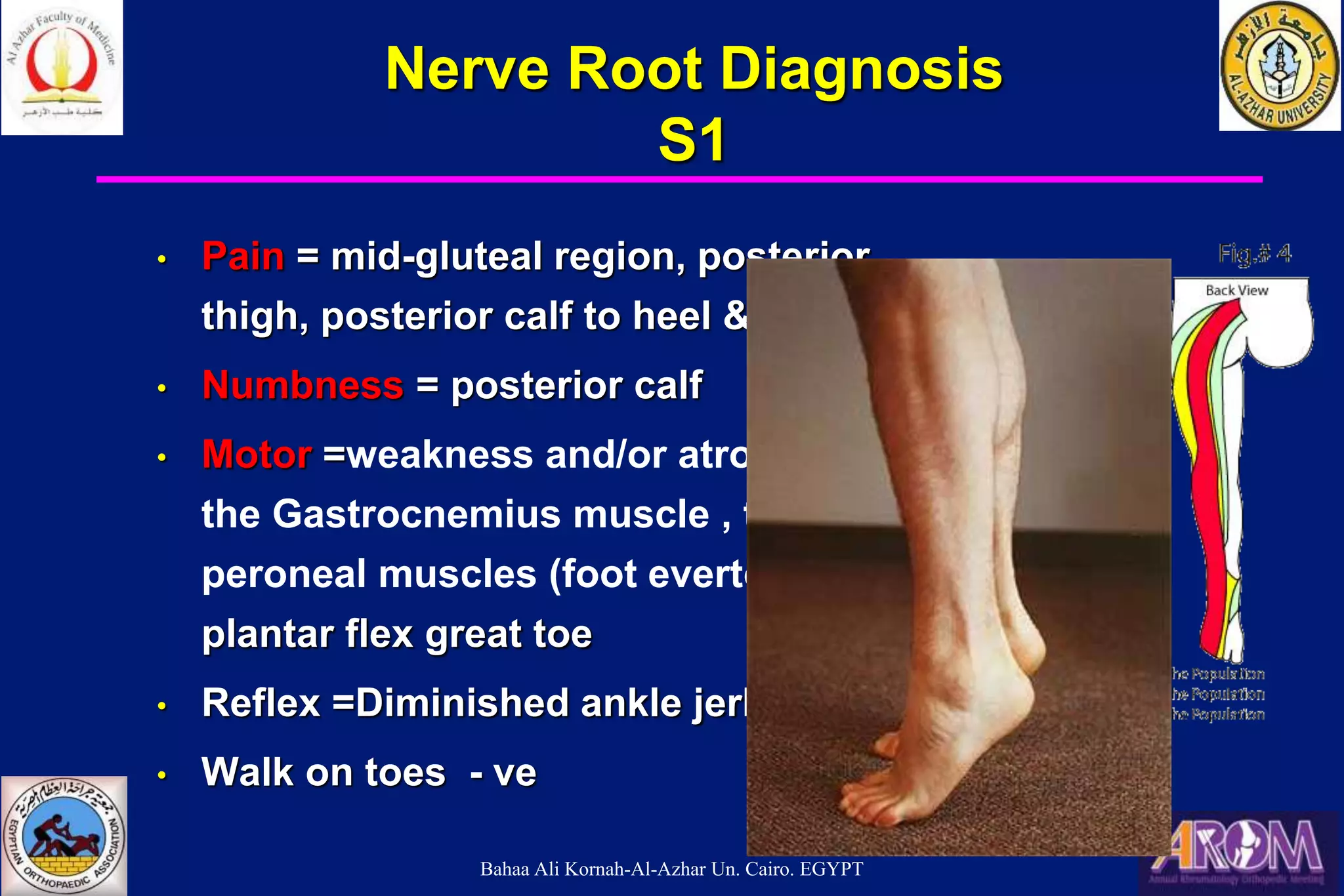 Sciatic conditions you treat conditions you refereed | PPT