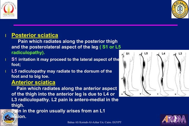 Sciatic conditions you treat conditions you refereed | PPT