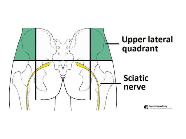 Sciatic Nerve Anatomy | PPTX