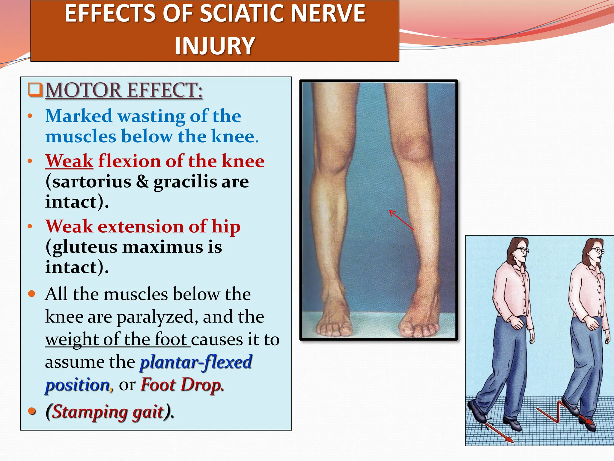 Sciatic Nerve.pdf Physiotherapy treatment | PPT
