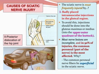 Sciatic Nerve.pdf Physiotherapy treatment | PPT