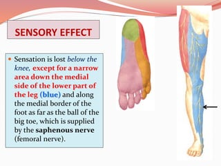 Sciatic Nerve.pdf Physiotherapy treatment | PPT