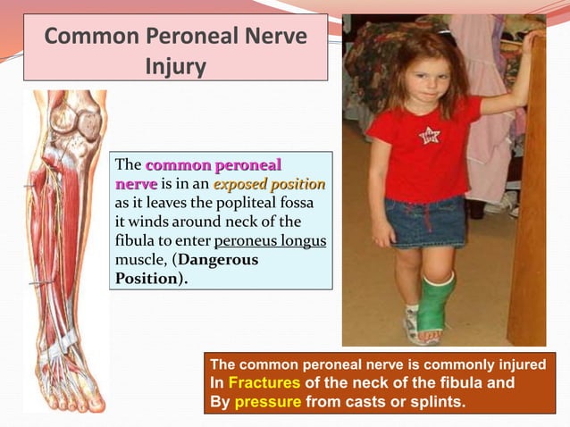 Sciatic Nerve.pdf Physiotherapy treatment | PPT
