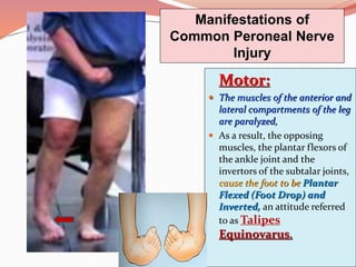 Sciatic Nerve.pdf Physiotherapy treatment | PPT