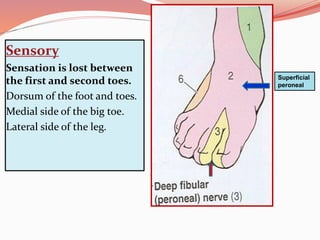 Sciatic Nerve.pdf Physiotherapy treatment | PPT