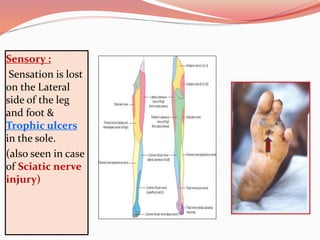 Sciatic Nerve.pdf Physiotherapy treatment | PPT
